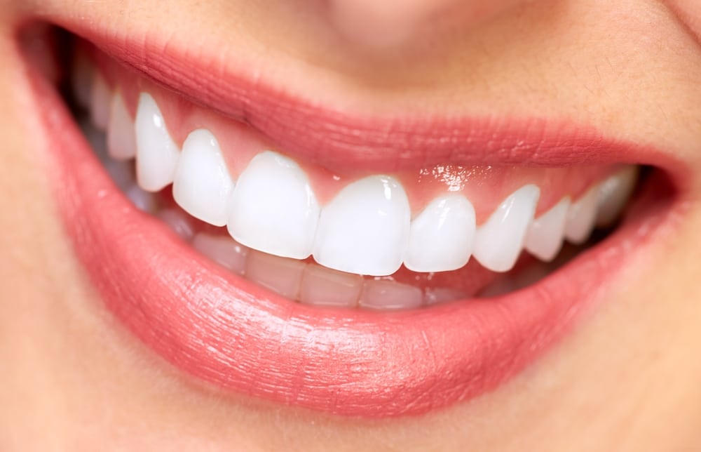 Discolored Gums in Beverly Hills | Dr. Alex Farnoosh