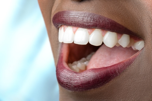Gum Bleaching in Los Angeles | Dark Gums | Periodontist in LA